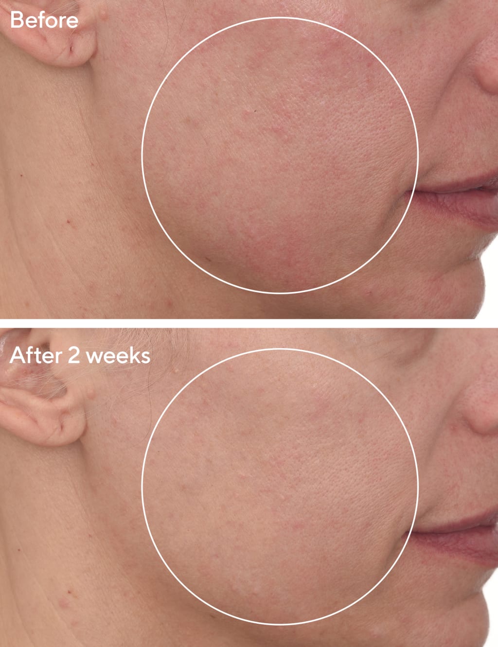 Cellular Hydration Barrier Repair Cream 50ml | Murad® | M&S