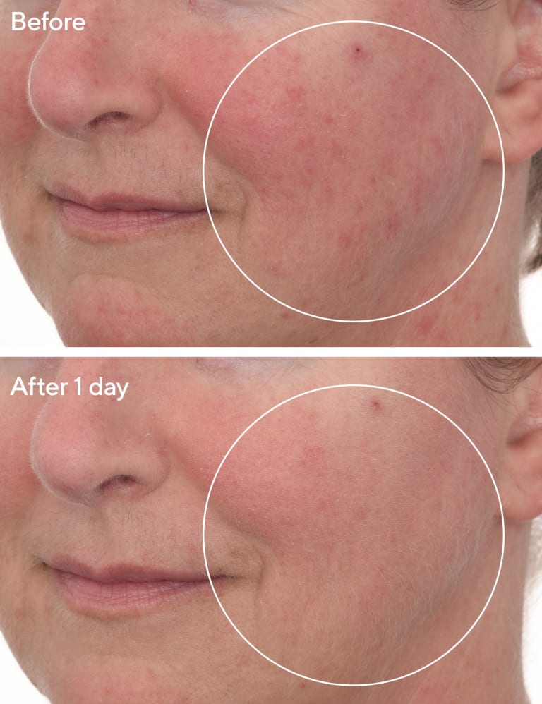 Cellular Hydration Barrier Repair Mask 80ml | Murad® | M&S