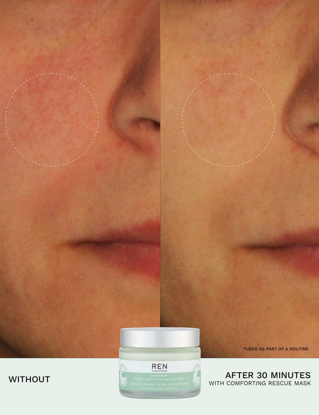 Evercalm™ Ultra Comforting Rescue Mask 50ml | REN | M&S