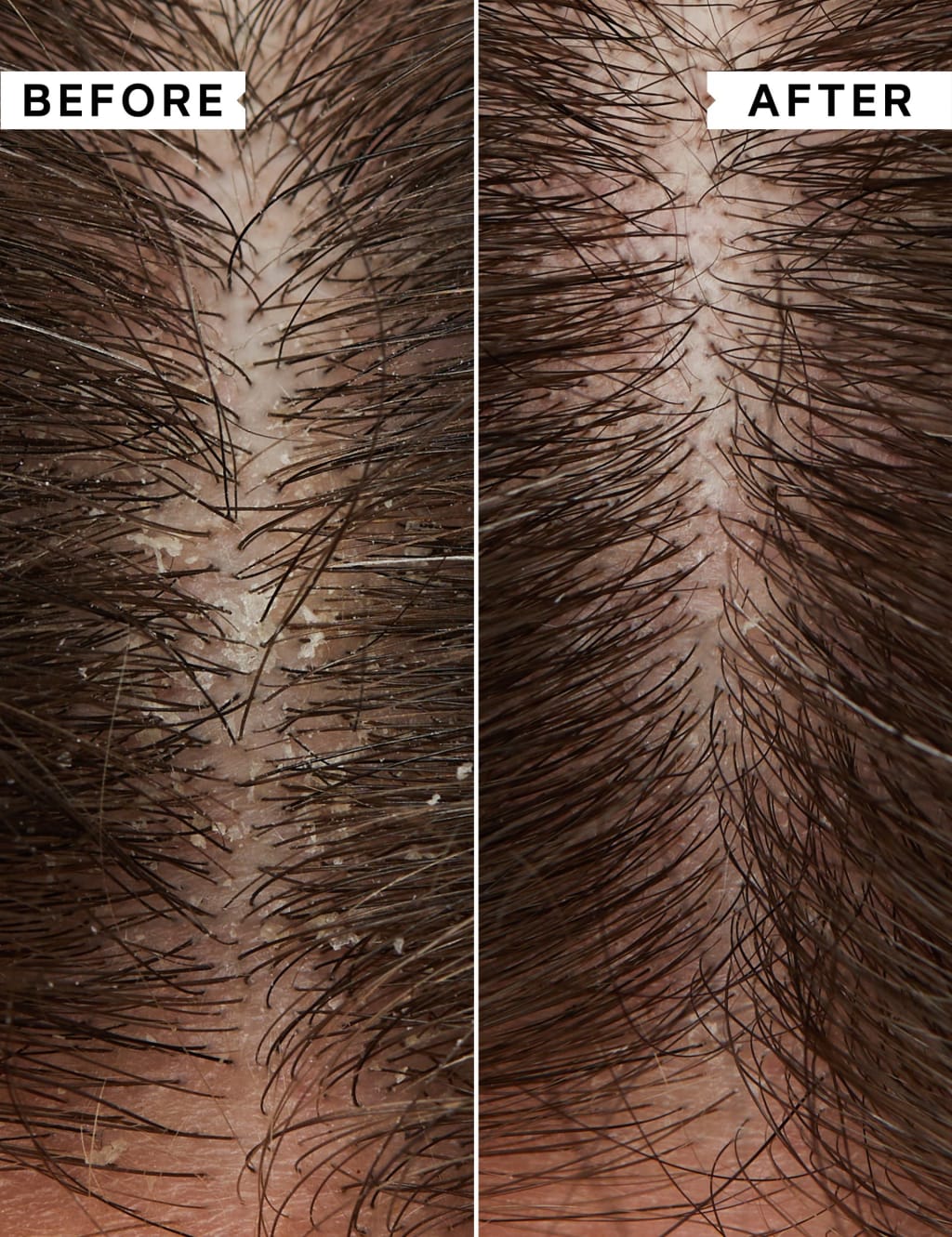 Flaky/Itchy Scalp Regime Kit | Philip Kingsley | M&S