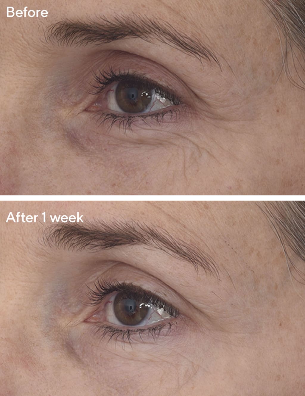 Retinal ReSculpt™ Eye Treatment 15ml | Murad® | M&S