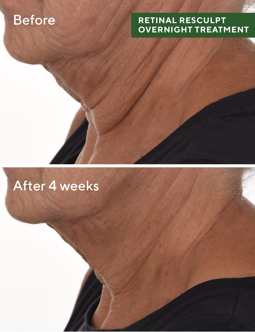 Retinal ReSculpt™ Overnight Treatment 30ml | Murad® | M&S