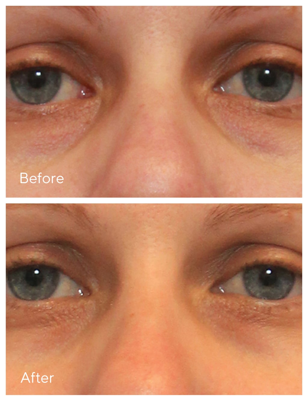 Vita-C Eyes Dark Circle Corrector 15ml | Murad® | M&S