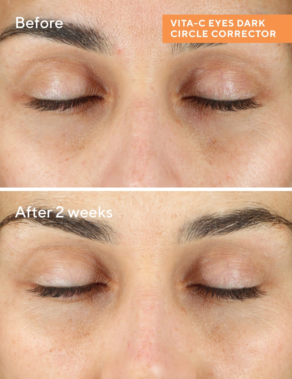 Vita-C Eyes Dark Circle Corrector 15ml | Murad® | M&S